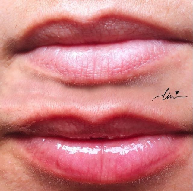 Hidragloss: tratamento brasileiro nutre e rejuvenesce os lábios