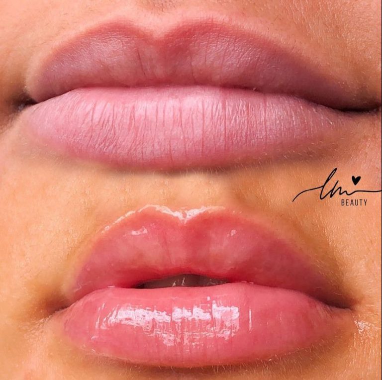 Hidragloss: tratamento brasileiro nutre e rejuvenesce os lábios