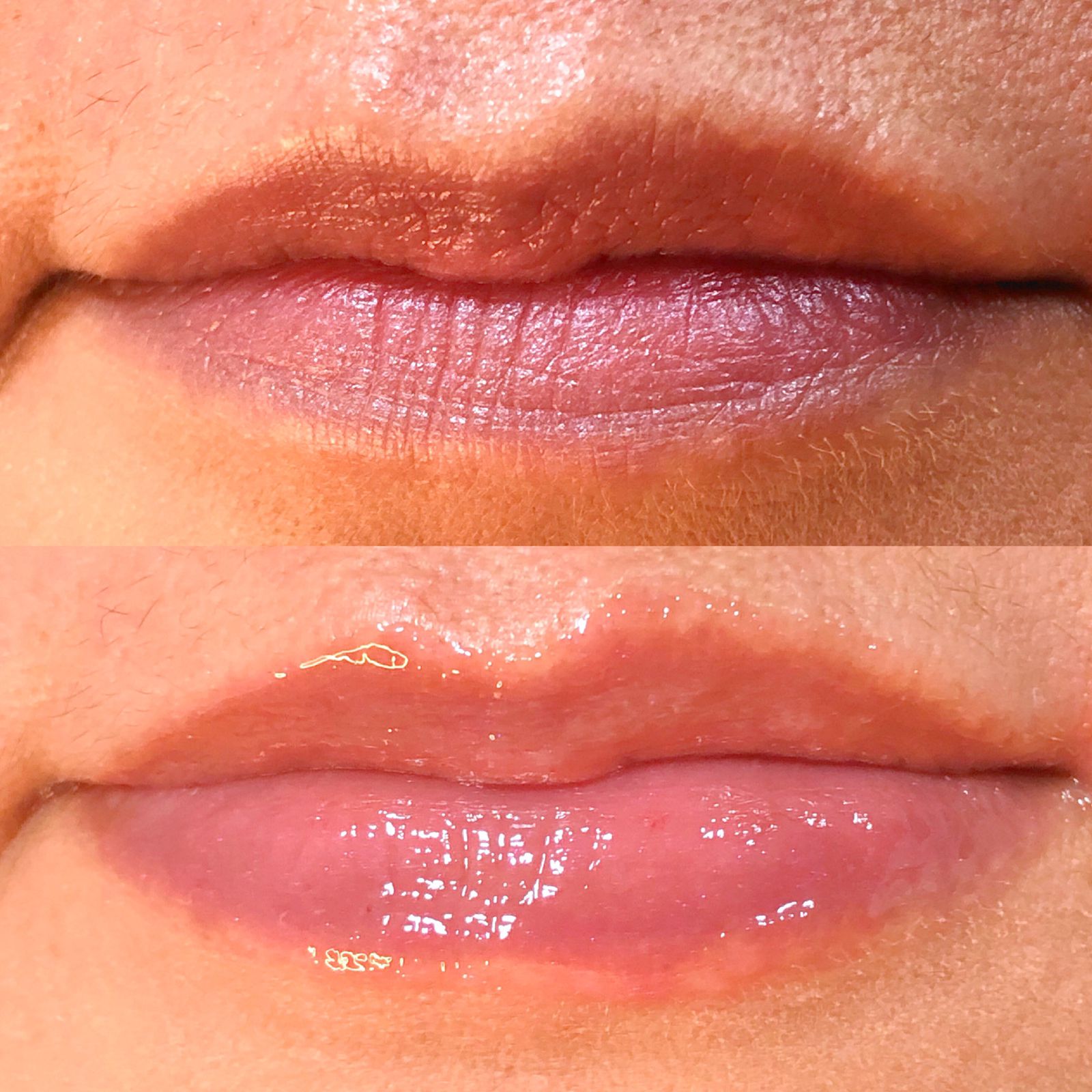 Hidragloss: tratamento brasileiro nutre e rejuvenesce os lábios